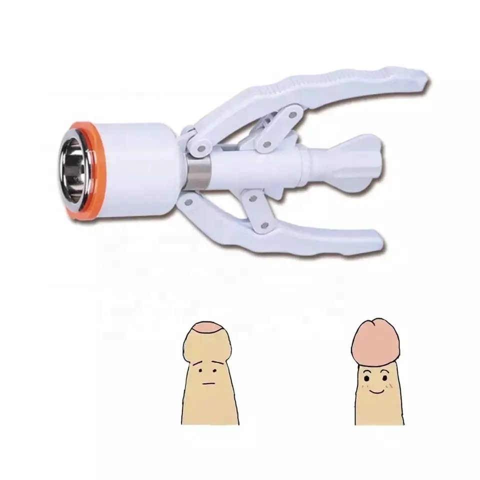 IN-G002 Manufacturer Wholesale Price Disposable Medical Foreskin Cut ...