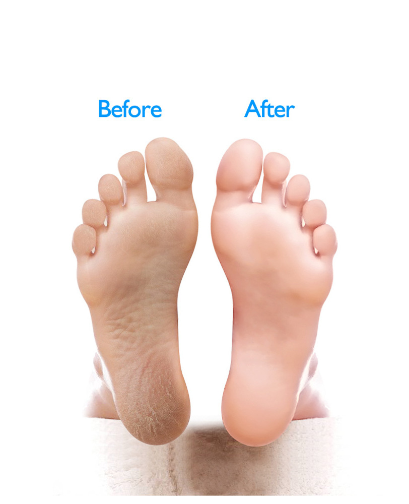 Online Order Low MOQ Professional Pedicure Electric Foot Rasp Foot File ...