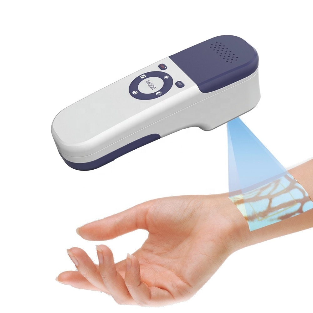 China Low Price Handheld Portable Infrared Vein Scanner Medical Vein ...