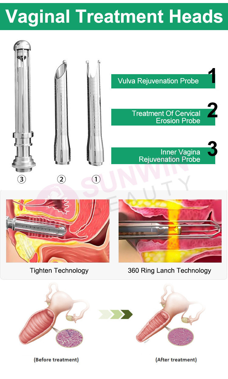 Medical Ce Co2 Fractional Laser Skin Rejuvenvation Co2 Surgical Laser ...