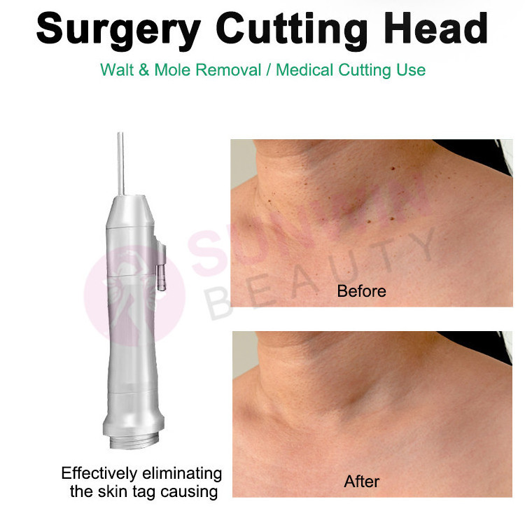 Medical Ce Co2 Fractional Laser Skin Rejuvenvation Co2 Surgical Laser ...